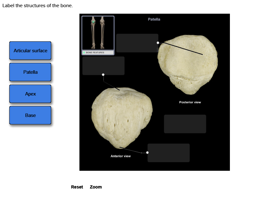 Solved Label the structures of the bone. | Chegg.com