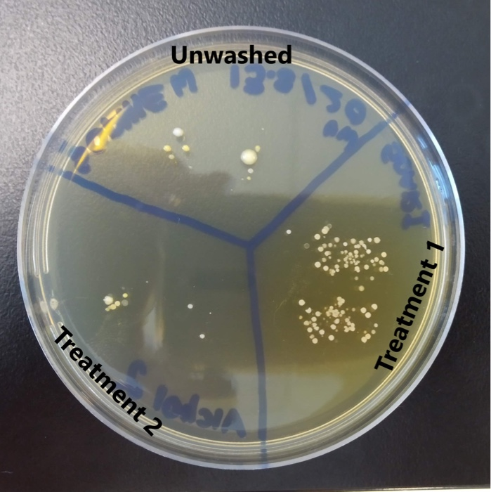 Solved Microflora of the Human Skin: Hand HygienePresent a | Chegg.com
