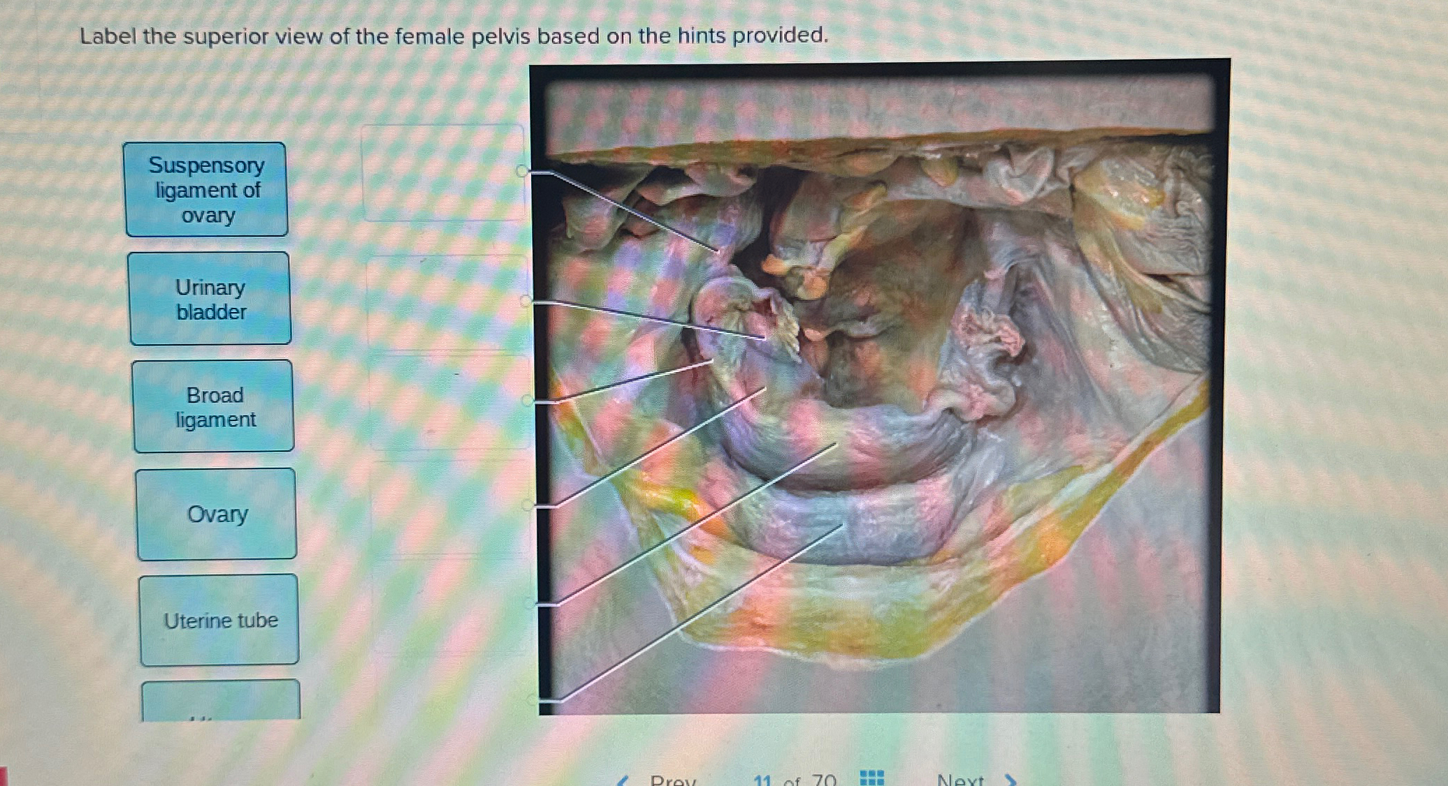 Solved Label the superior view of the female pelvis based on | Chegg.com