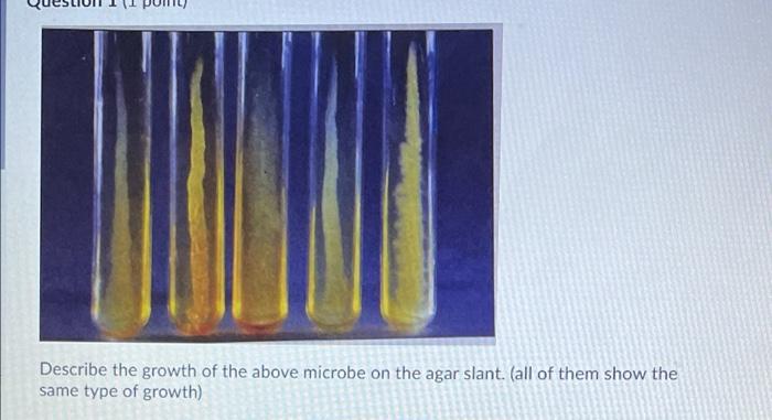 Solved Describe the growth of the above microbe on the agar | Chegg.com