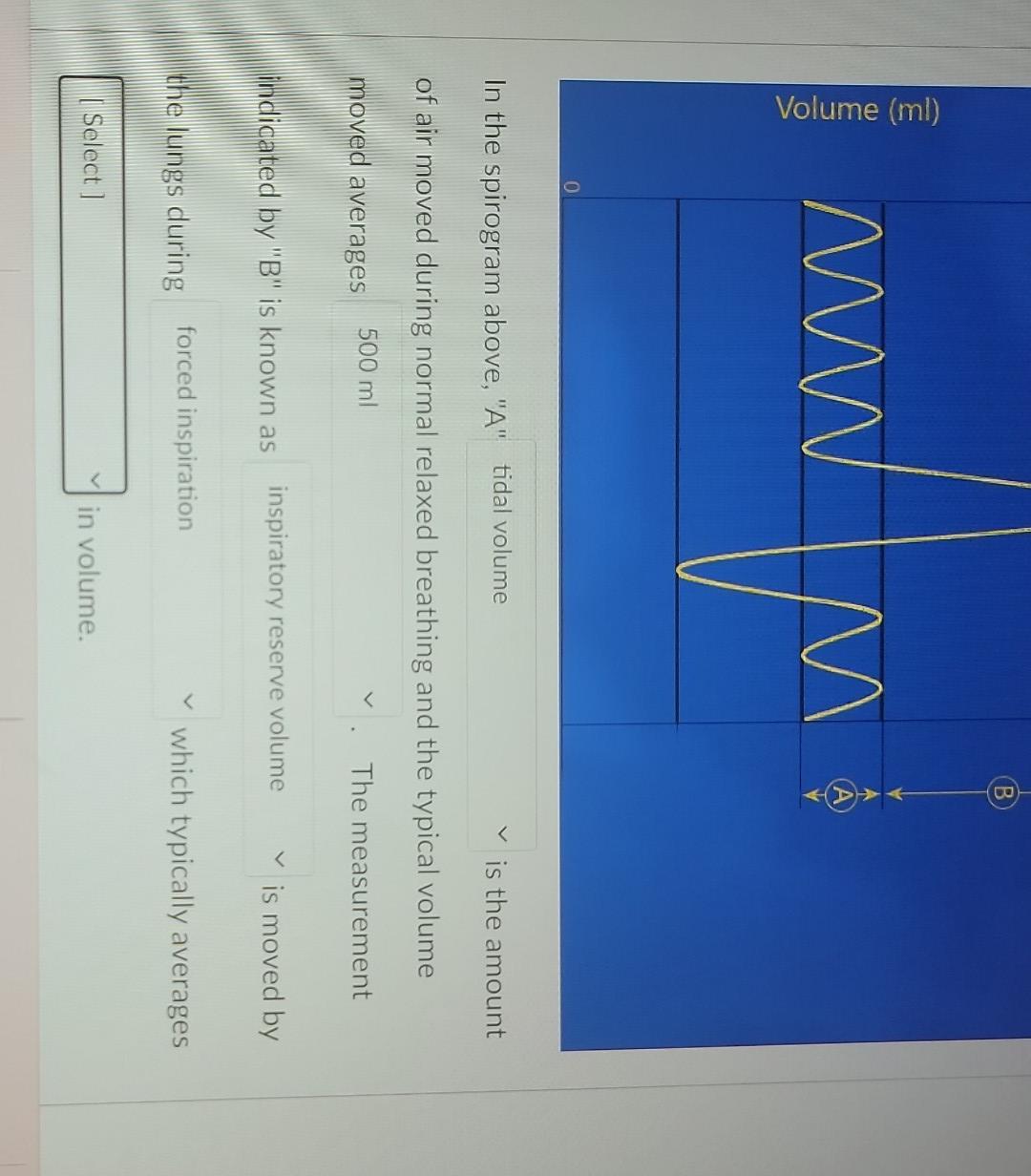 Solved In the spirogram above, "A" tidal volume is the | Chegg.com