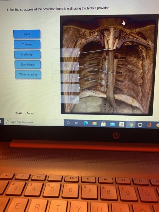 Solved Label the structures of the posterior thoracic wall | Chegg.com