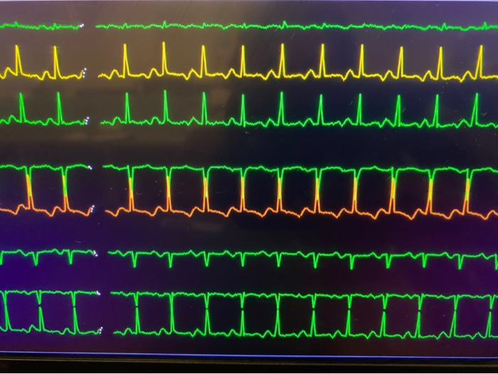 Solved whichinhahahahahahahahahah whicho | Chegg.com