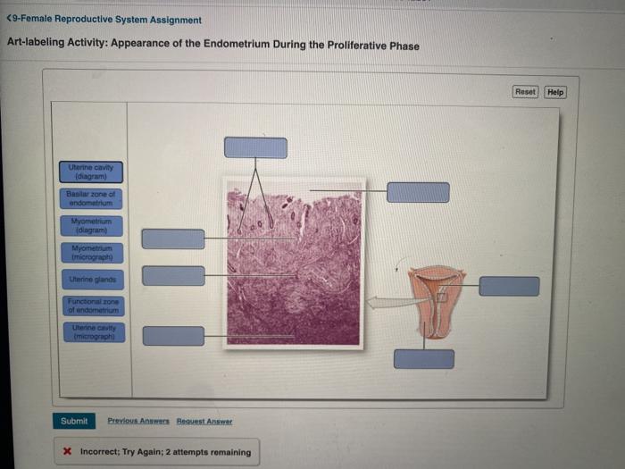 Solved Female Reproductive System AssigmentArt- labeling | Chegg.com