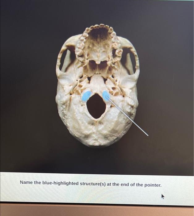Solved Name the blue-highlighted structure(s) at the end of | Chegg.com