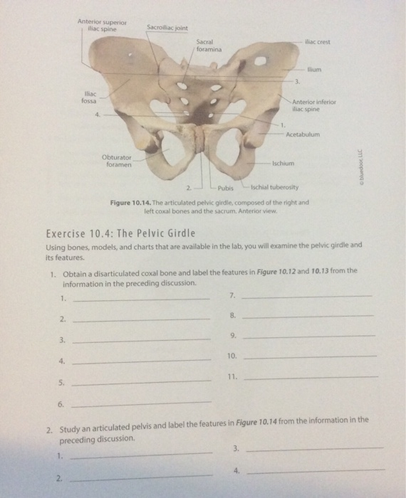 Solved Anterior superior iac spine Sacroiliac joint iliac | Chegg.com