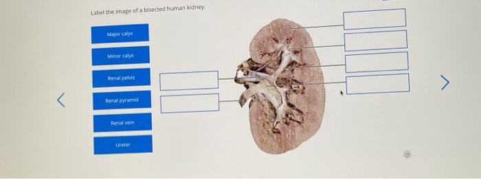 Solved Label the image of a bisected human kidney Major caly | Chegg.com