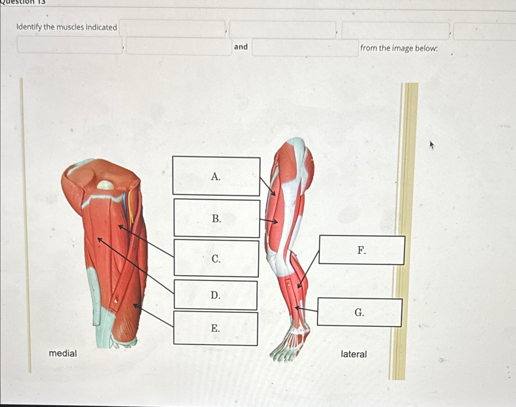 Solved Identify the muscles indicatedand from the image | Chegg.com