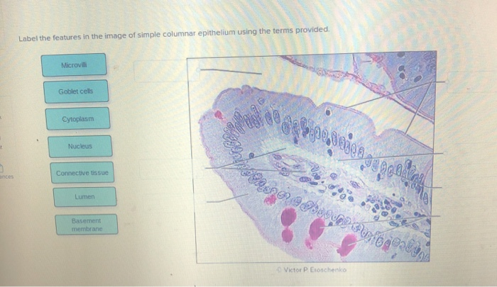 Solved Label the features in the image of simple columnar | Chegg.com