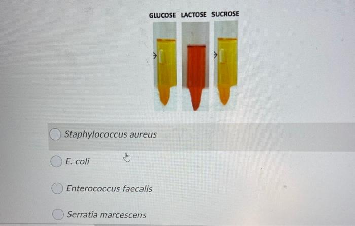 Solved The Reason Why The Phenol Red Broth May Turn Dark