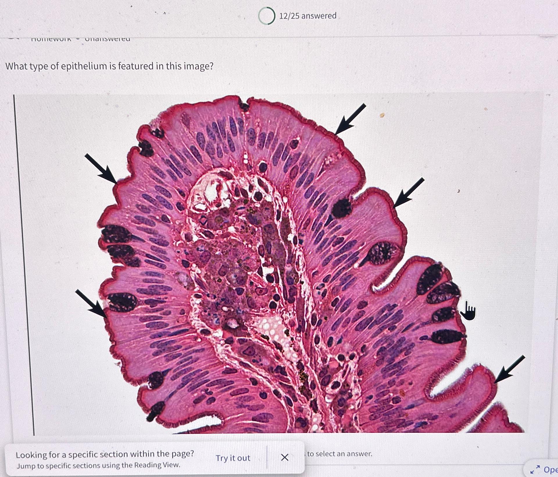 Solved 1225 ﻿answeredWhat type of epithelium is featured in | Chegg.com