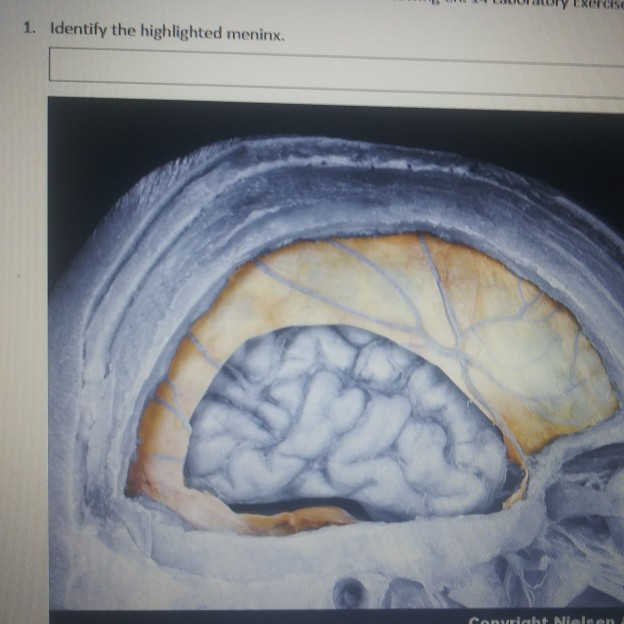 Solved identify the highlighted meninx brain | Chegg.com