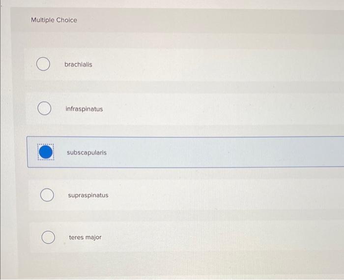 Solved Which structure is highlighted? Multiple Choice | Chegg.com