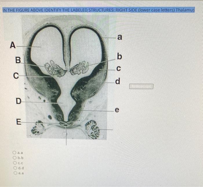 Solved IN THE FIGURE ABOVE IDENTIFY THE LABELED. STRUCTURES: | Chegg.com