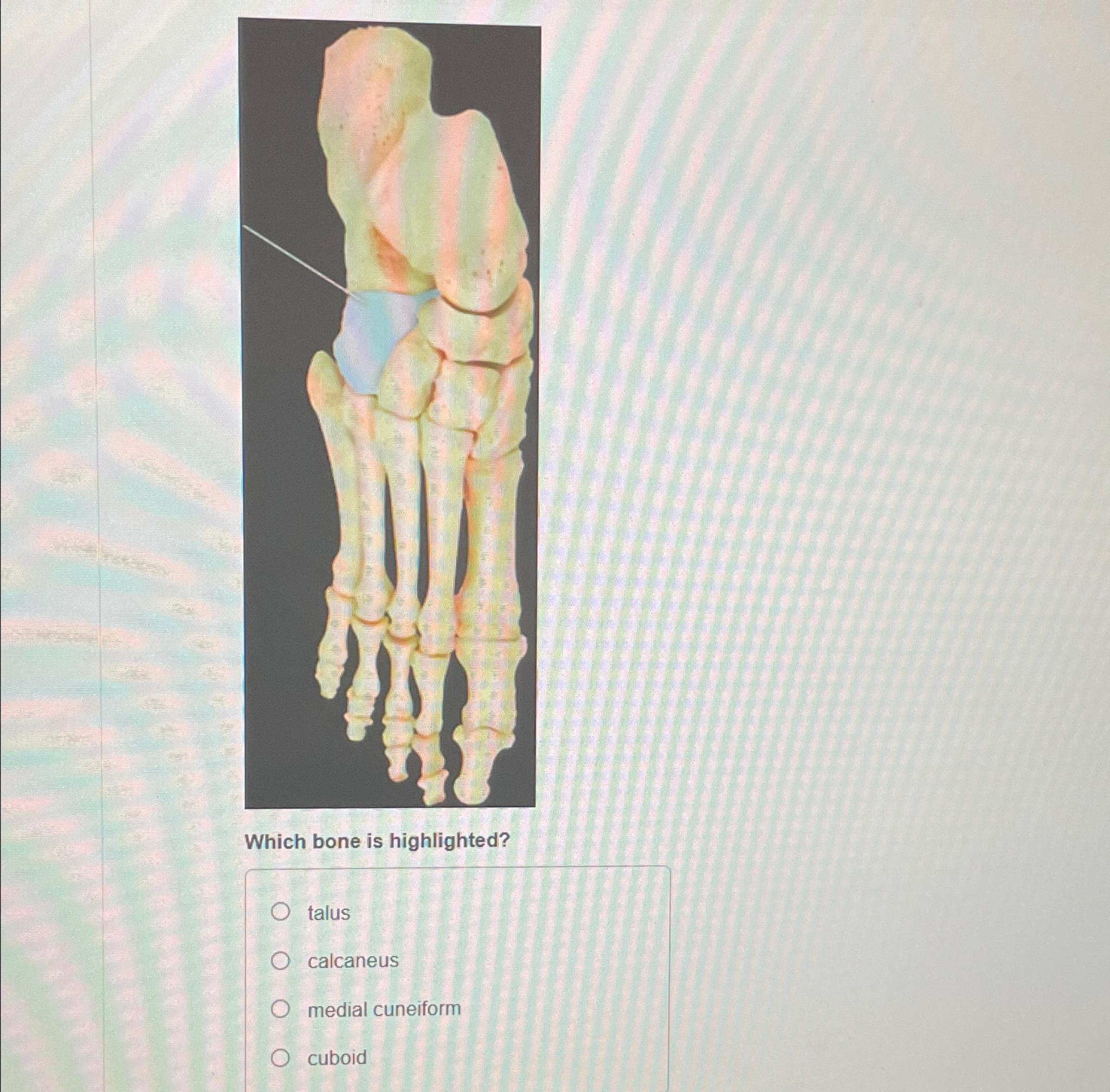 Solved Which bone is highlighted?taluscalcaneusmedial | Chegg.com