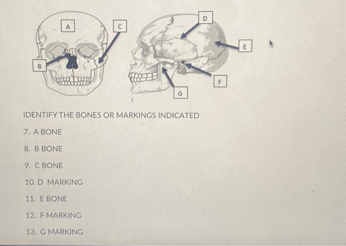 Solved IDENTIFY THE BONES OR MARKINGS INDICATED 7. ABONE 8. | Chegg.com