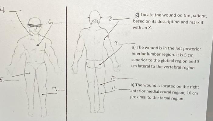 Solved 4. 8 6. 8) Locate the wound on the patient, based on | Chegg.com