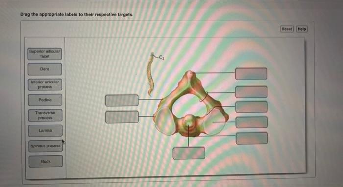 Solved Drag the appropriate labels to their respective | Chegg.com