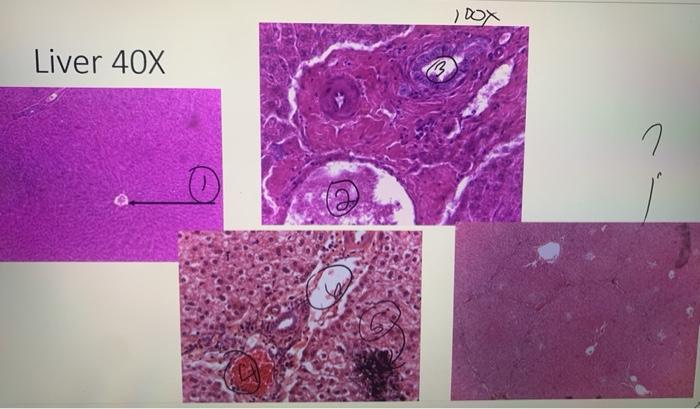 Solved Tonsil 40X Esophagus 40x D3 Tongue 100% DOX Liver | Chegg.com