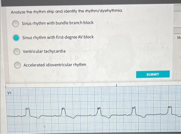 Solved Analyze the rhythm strip and identify the | Chegg.com