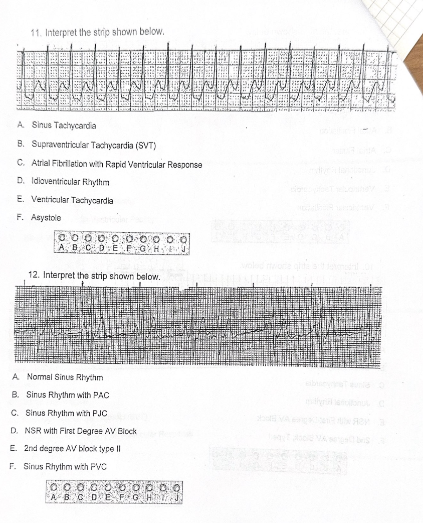Solved 11. ﻿Interpret the strip shown below. A. ﻿Sinus | Chegg.com