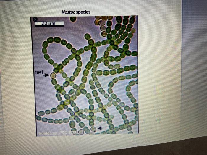 Solved Nostoc species 202 het poncho Nostoc , C 206 7. | Chegg.com