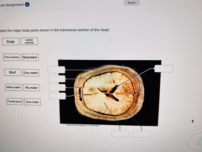 Solved abel the major body parts shown in the transverse | Chegg.com
