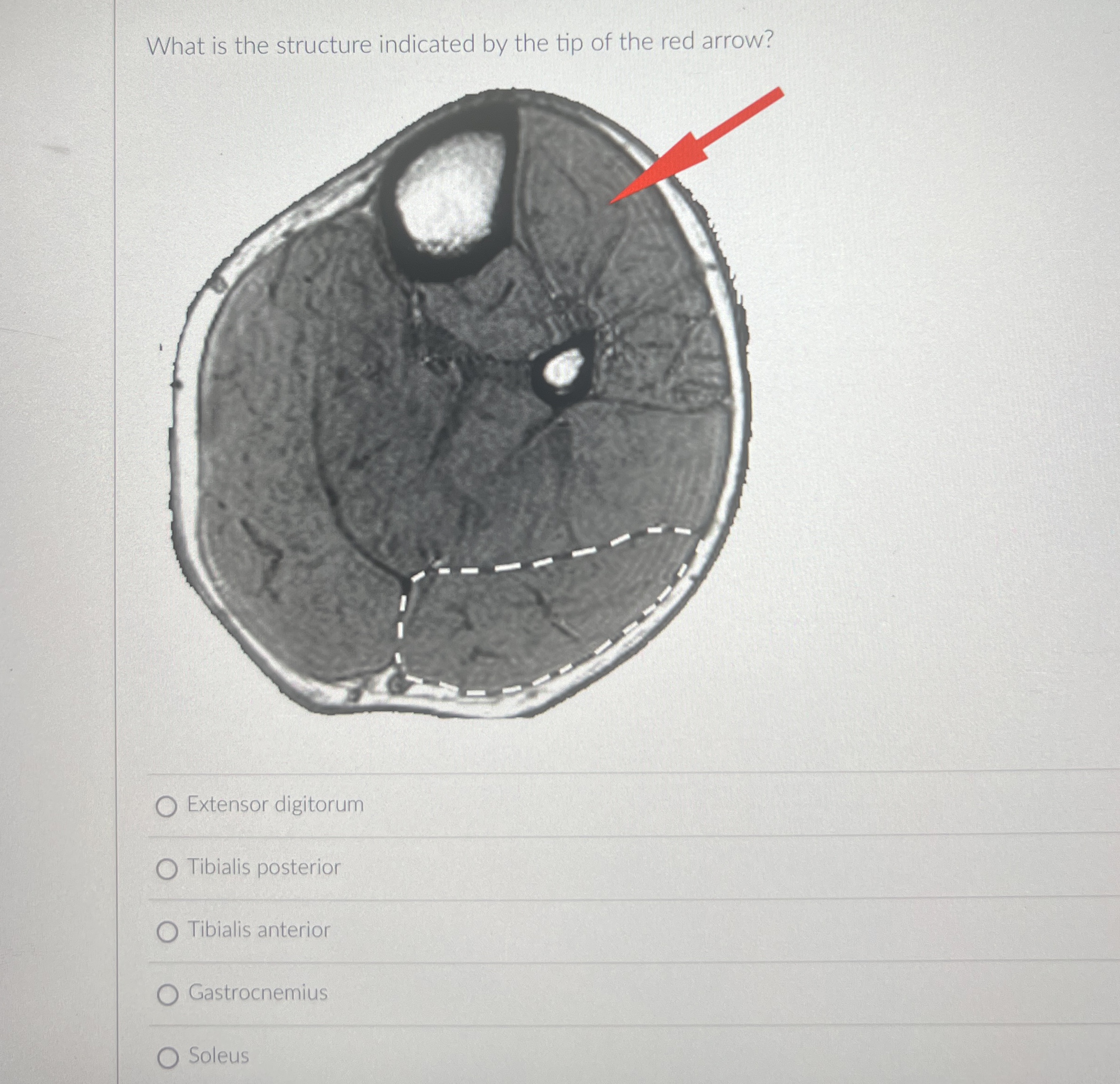 Solved What is the structure indicated by the tip of the red | Chegg.com