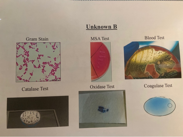 Solved Unknown B Gram Stain MSA Test Blood Test Coagulase | Chegg.com