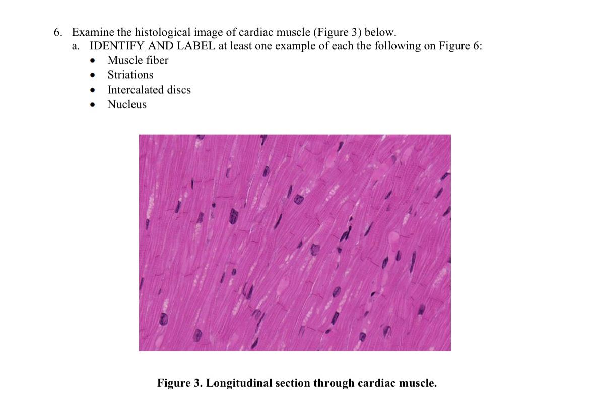 Solved Examine the histological image of cardiac muscle | Chegg.com