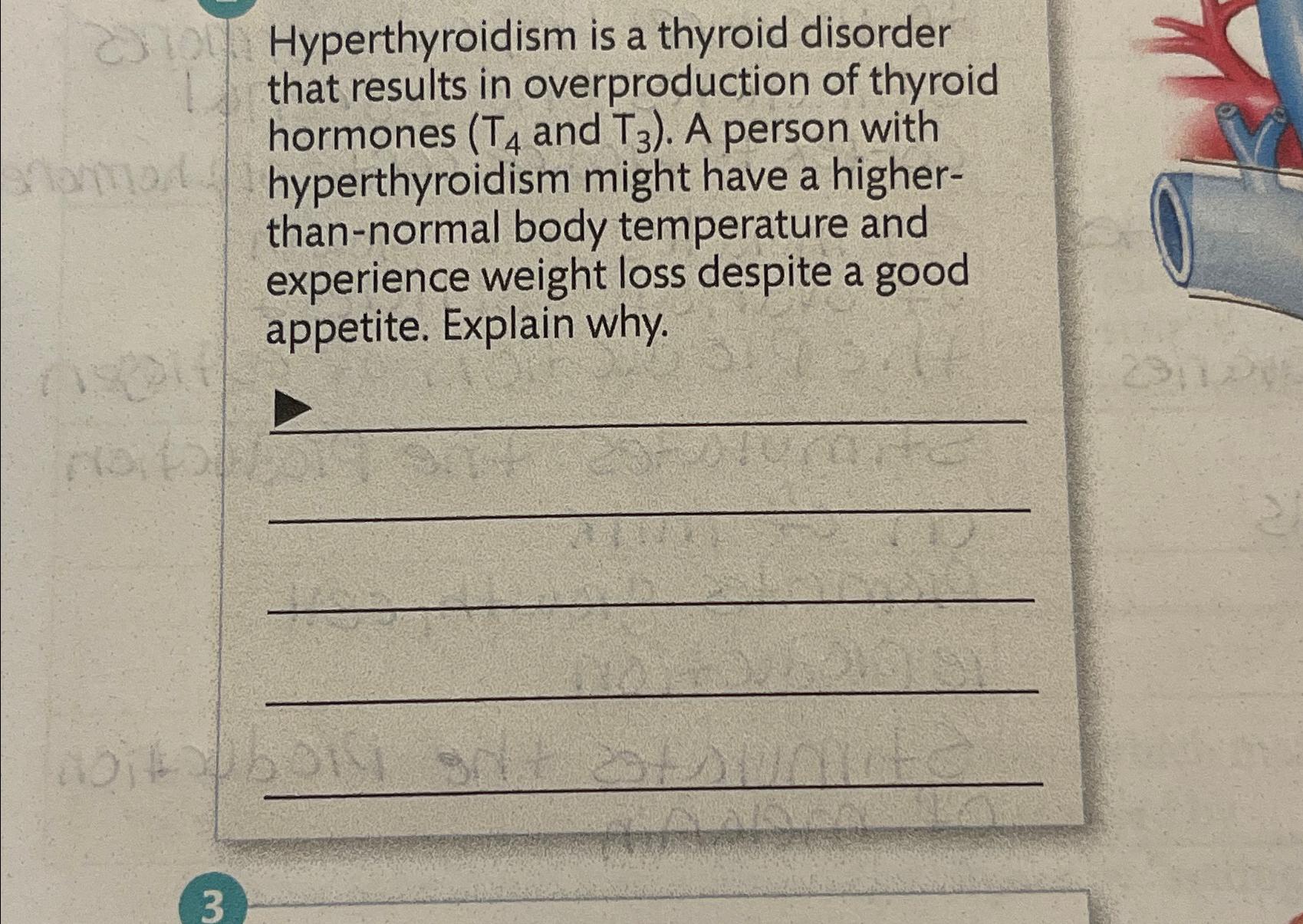 Solved Hyperthyroidism is a thyroid disorder that results in | Chegg.com