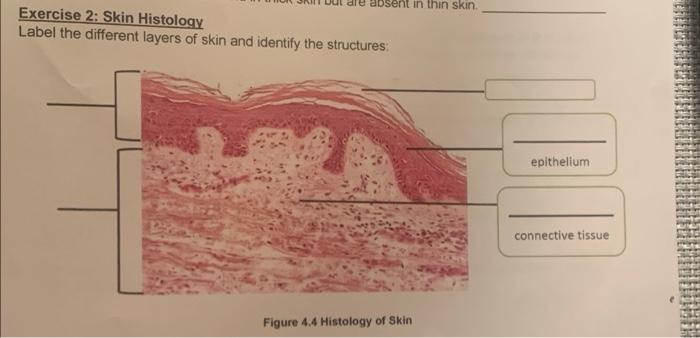 Solved absent in thin skin Exercise 2: Skin Histology Label | Chegg.com