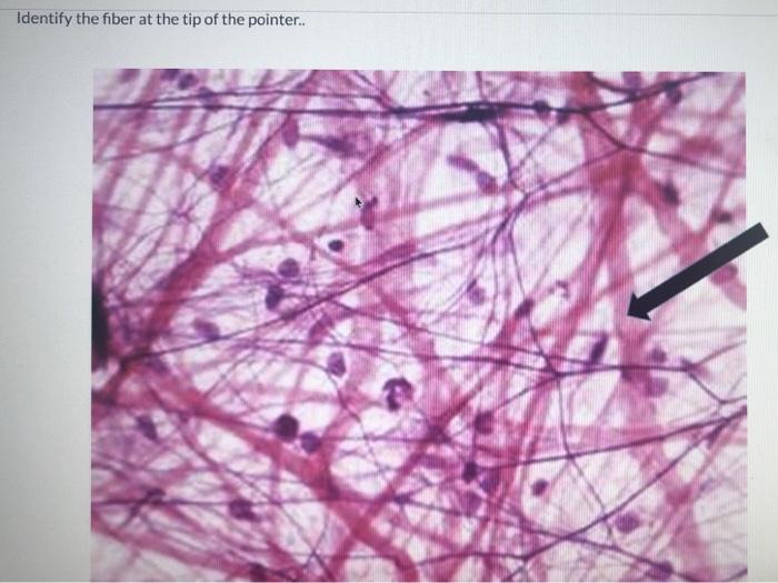 Solved Identify the fiber at the tip of the pointer.. | Chegg.com