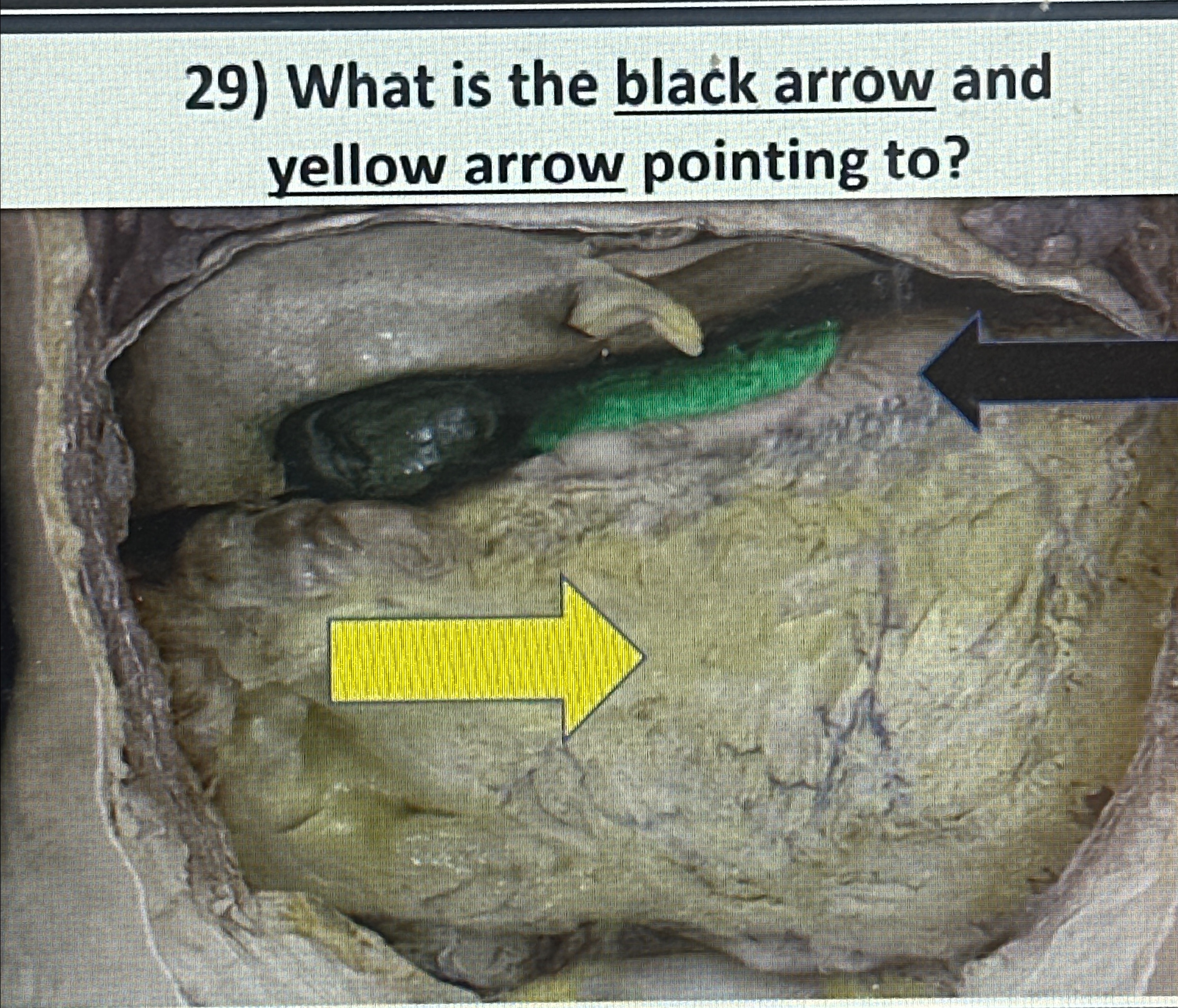 Solved What is the black arrow and yellow arrow pointing to? | Chegg.com