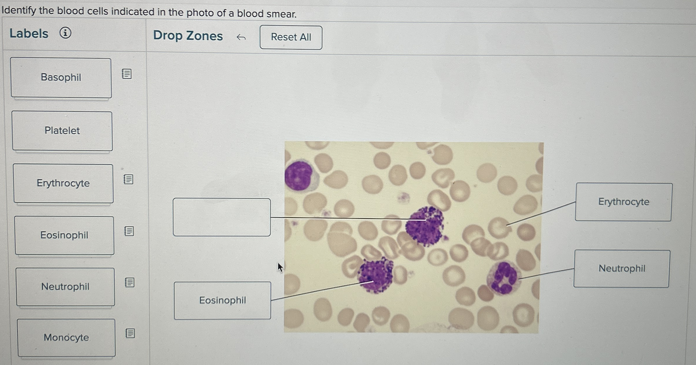 Solved Identify the blood cells indicated in the photo of a | Chegg.com