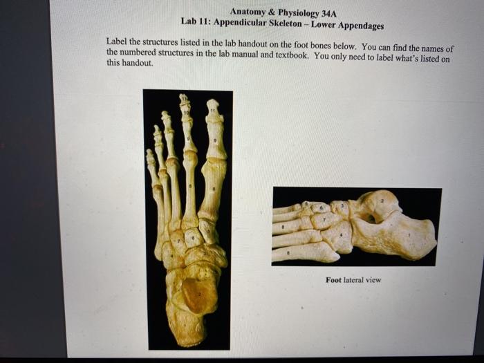 Solved Lab 10: Appendicular Skeleton - Lower Appendages | Chegg.com