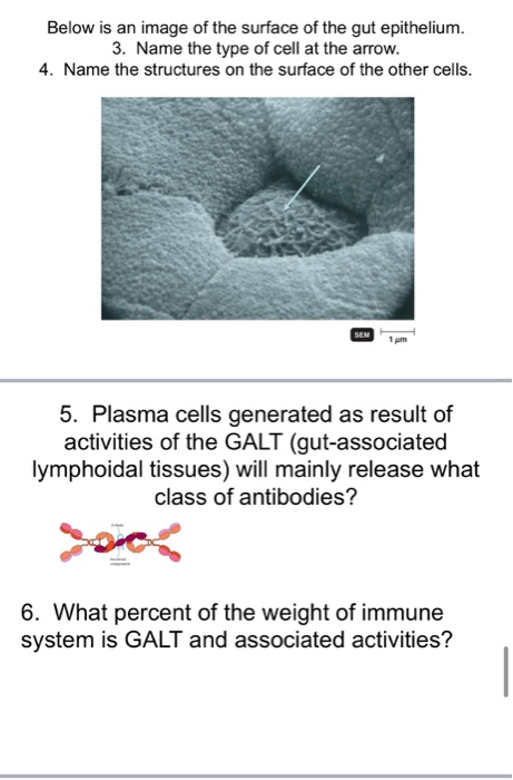 Solved 1. Helper T cells recognize antigen presented by | Chegg.com