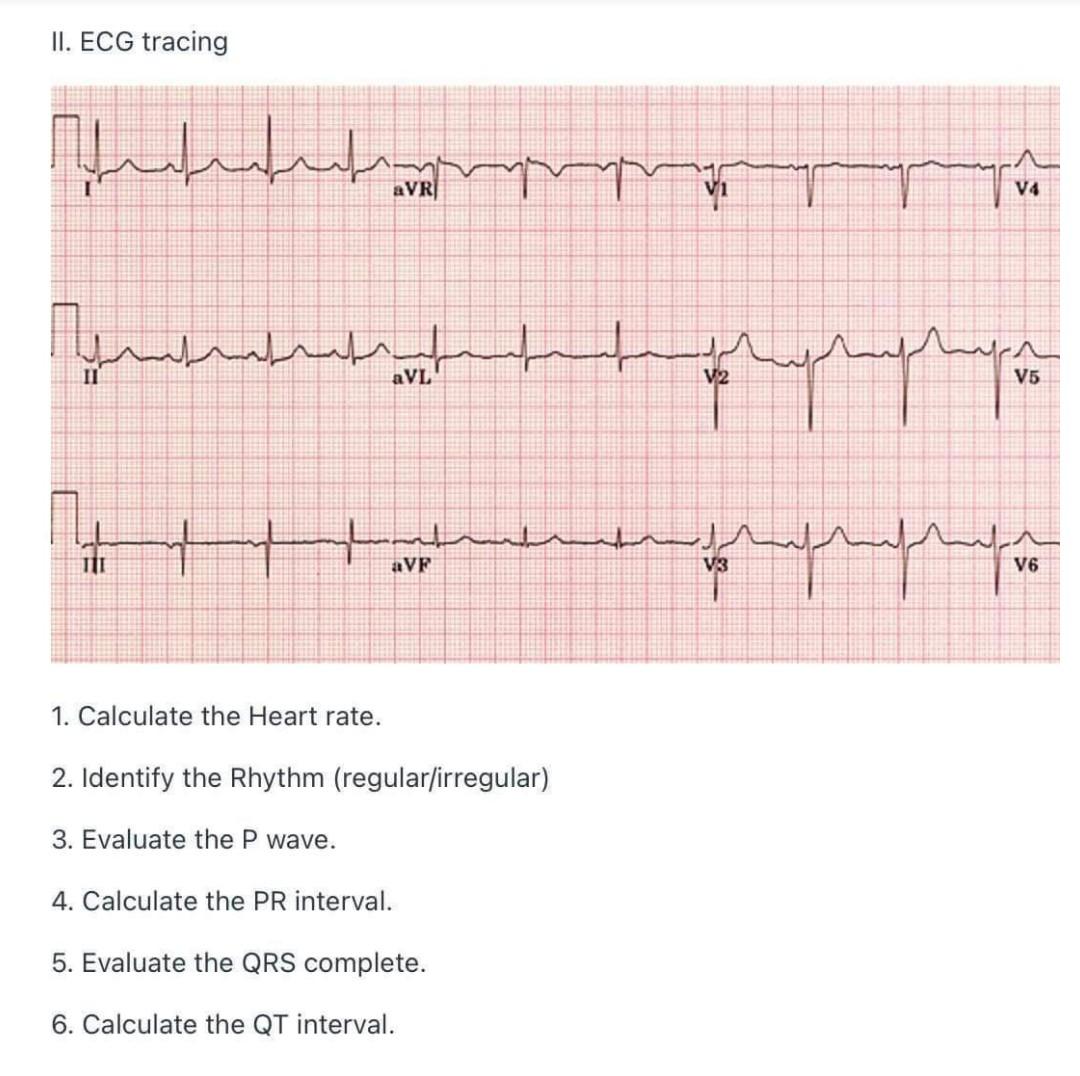 Solved II. ECG tracing المللی AVR] V1 V4 پہلی مسلم لعلمها | Chegg.com