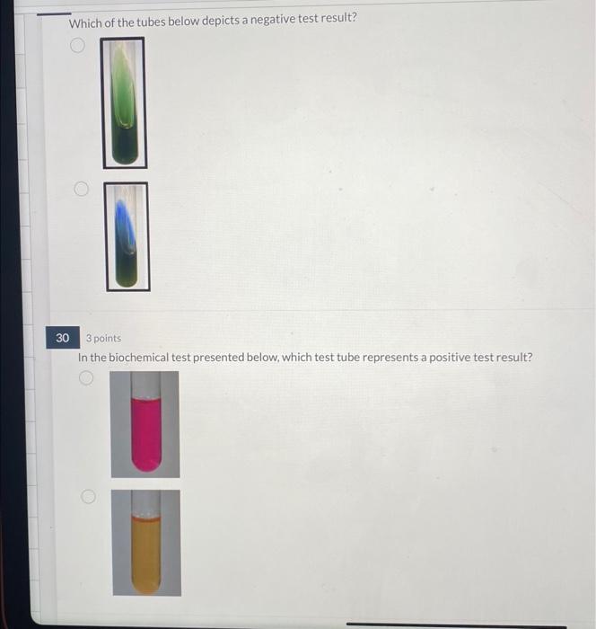 Solved Which of the tubes below depicts a negative test | Chegg.com