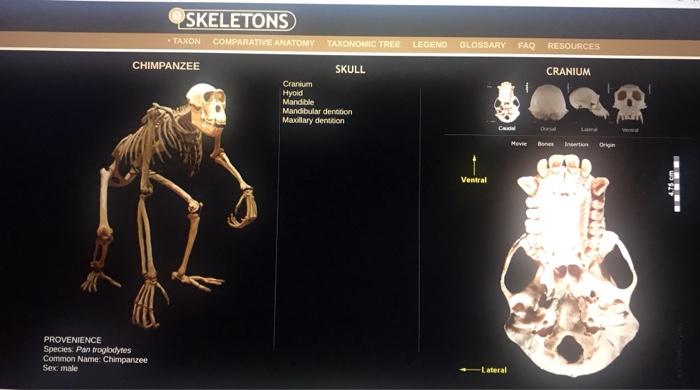 Solved Compare the anatomy of the modern human femur with | Chegg.com