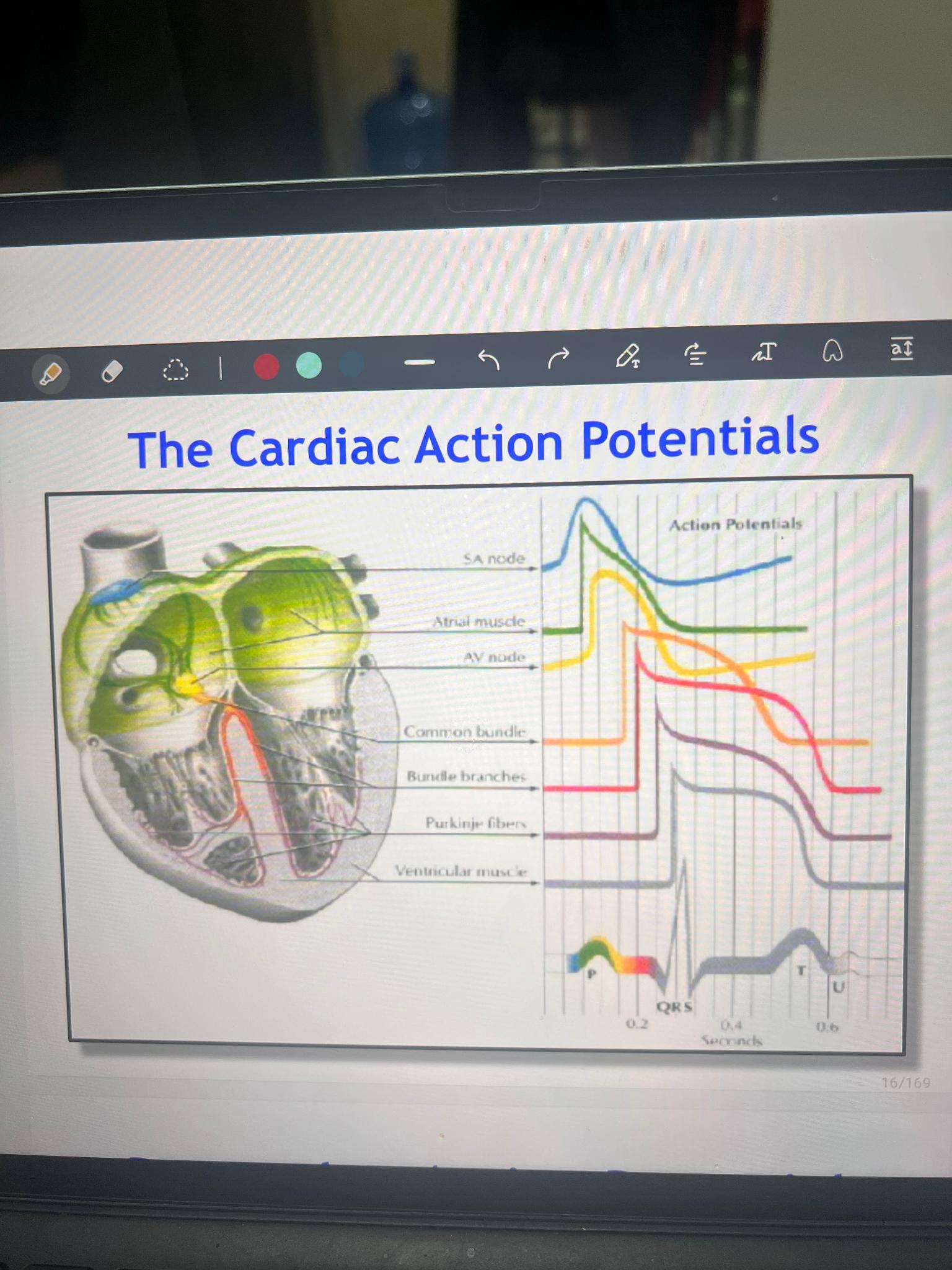 Solved Explain this: The Cardiac Action Potentials | Chegg.com