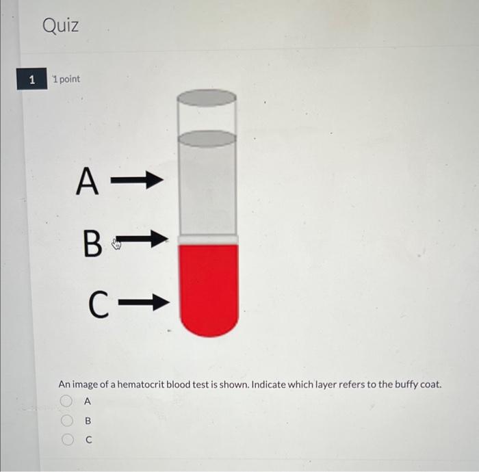 Solved A An image of a hematocrit blood test is shown. | Chegg.com