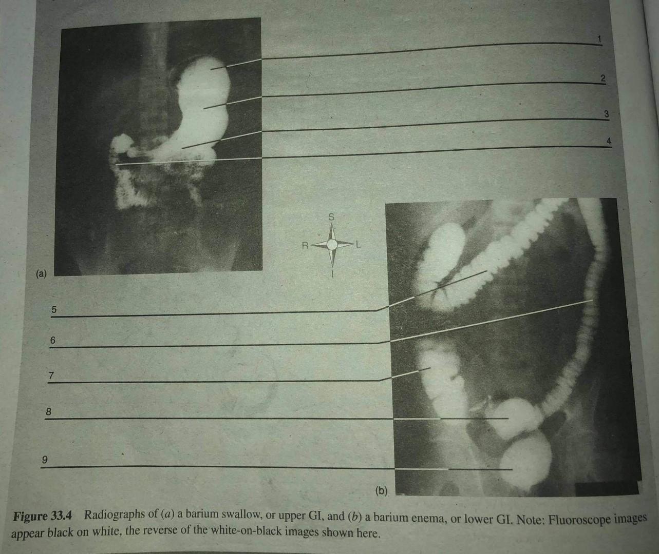 Solved (a) 5 6 7 8 9 (b) Figure 33.4 Radiographs of (a) a | Chegg.com