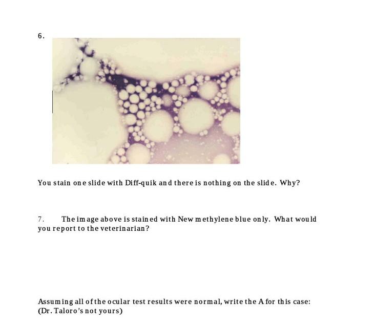 Solved 6. You stain one slide with Diff-quik and there is | Chegg.com