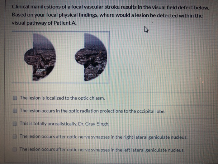 Solved Clinical manifestions of a focal vascular stroke | Chegg.com