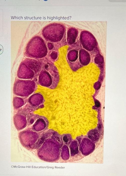 Solved which structure is highlighted?medulla of lymph | Chegg.com