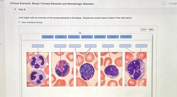 Solved Clinical Scenario: Blood- Formed Elements and | Chegg.com