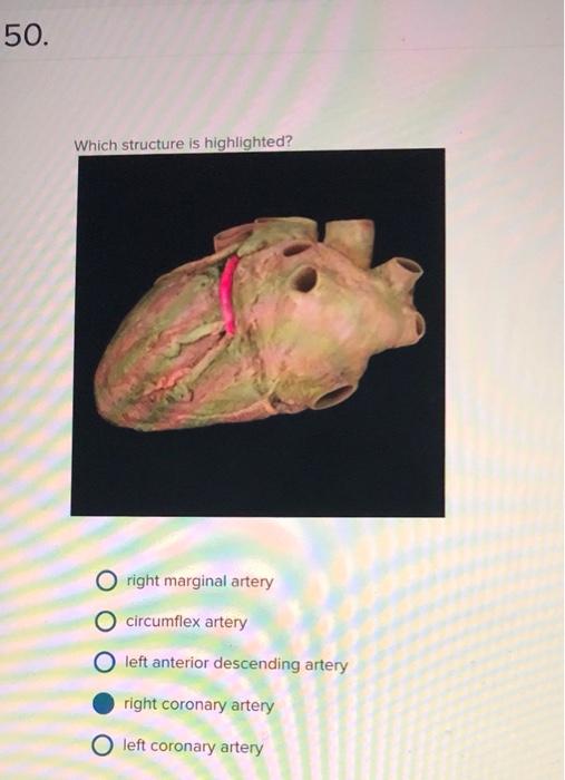 Solved 50. Which structure is highlighted? right marginal | Chegg.com