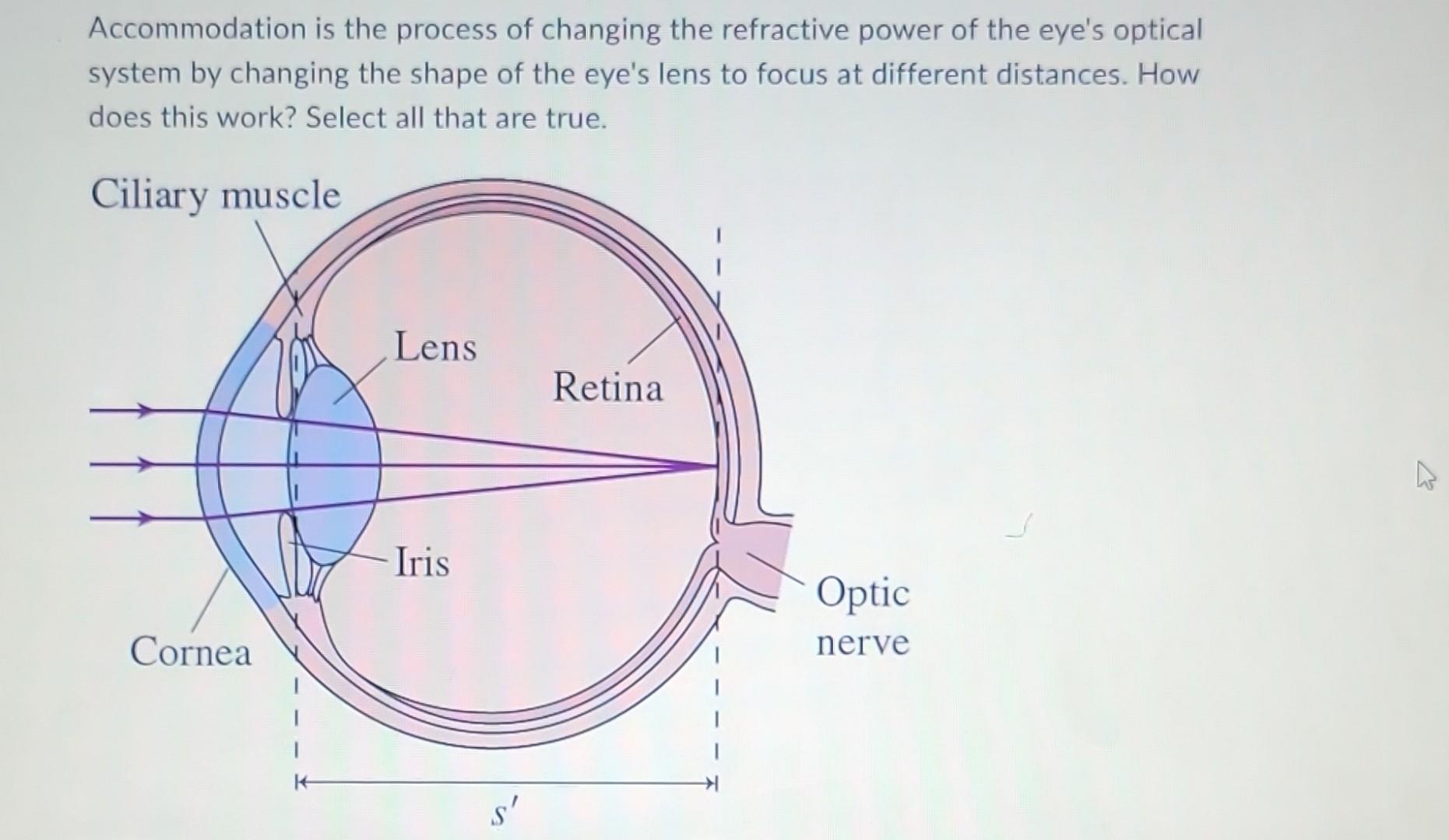 Solved Accommodation is the process of changing the | Chegg.com