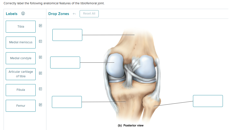 Solved Correctly label the following anatomical features of | Chegg.com